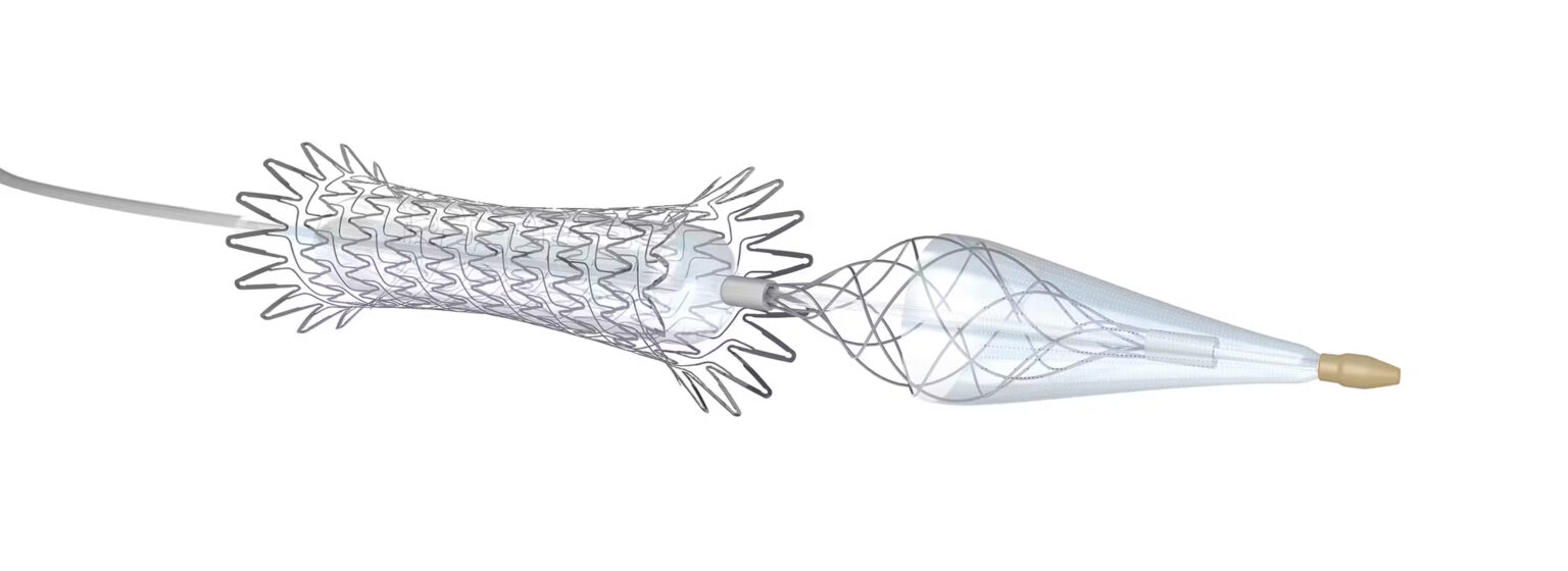 Medtronic fully launches Neuroguard IEP system - Vascular Specialist